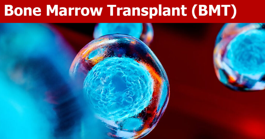 Bone Marrow Transplant (BMT) – Chinmaya IAS Academy – Current Affairs