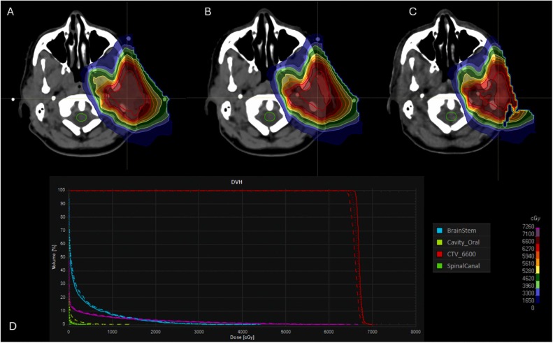 Step-and-Shoot Spot-Scanning Proton Arc Therapy (SPArc) – Chinmaya IAS ...